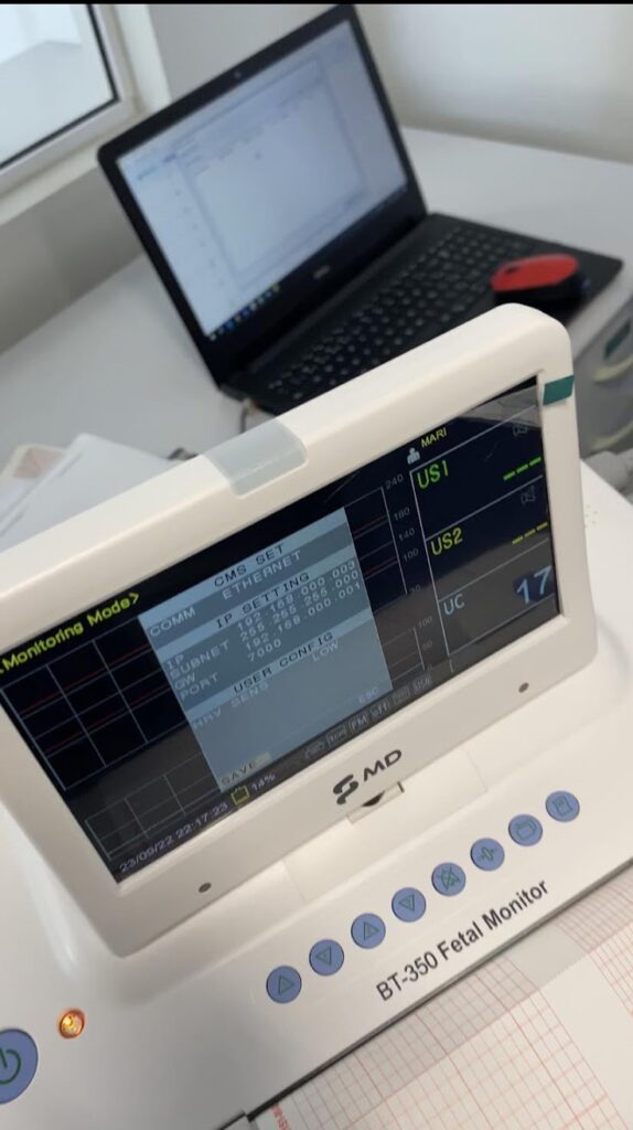 Cardiotocógrafo: o que é, quais são os principais componentes e ...